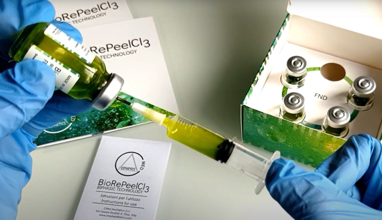 BioRePeel 35% TCA Peel Gives Great Results With No Pain or Downtime