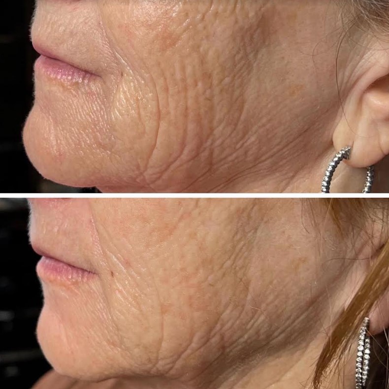 Jet Plasma Training - Add Jet Plasma To The Services You Offer!